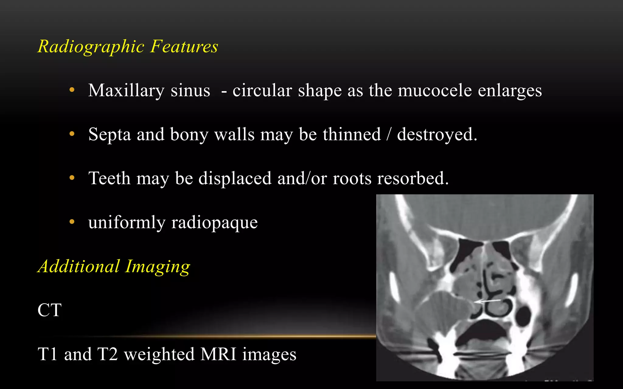 Differential diagnosis of haziness of maxillary sinus | PPTX