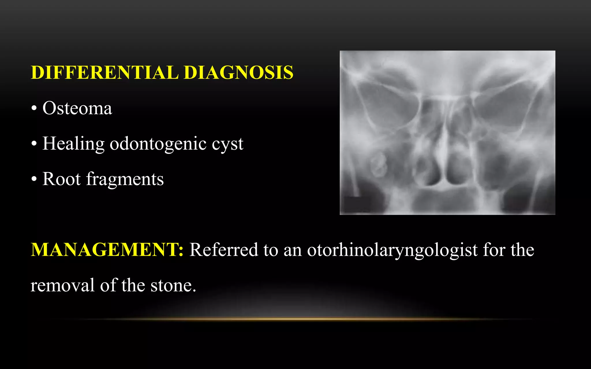 Differential diagnosis of haziness of maxillary sinus | PPTX