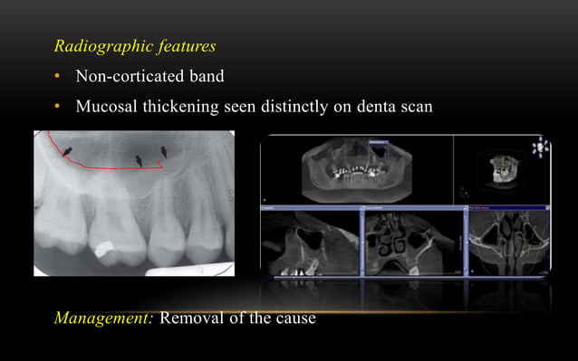 Differential diagnosis of haziness of maxillary sinus | PPTX | Ear ...