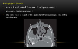 Differential diagnosis of haziness of maxillary sinus | PPTX