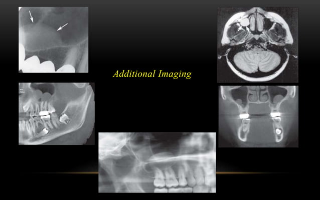 Differential diagnosis of haziness of maxillary sinus | PPTX | Ear ...