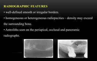 Differential diagnosis of haziness of maxillary sinus | PPTX | Ear ...