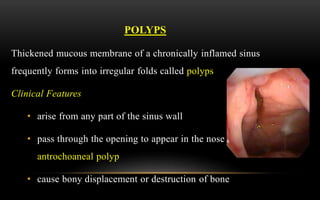Differential diagnosis of haziness of maxillary sinus | PPTX