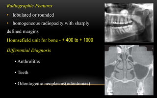 Differential diagnosis of haziness of maxillary sinus | PPTX | Ear ...