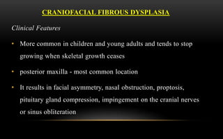 Differential diagnosis of haziness of maxillary sinus | PPTX
