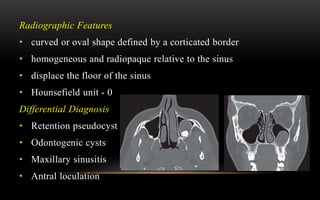 Maxillary Sinus Antrum