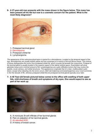 11 Objective Structured Clinical Examination (OSCE)) quiz-ophthalmology ...