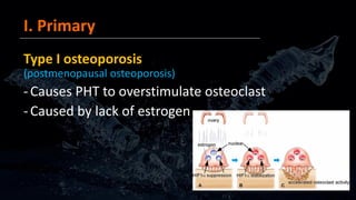 #11 osteoporosis | PPT