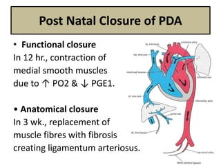 pathophysiology of ductal dependant for pulmonary | PPT