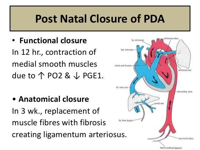 pathophysiology of ductal dependant for pulmonary