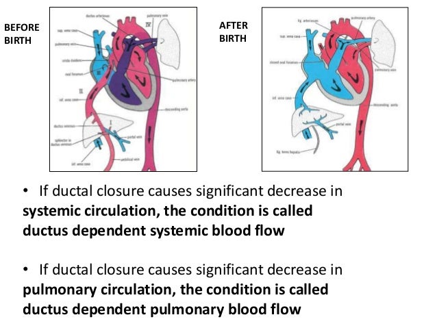 pathophysiology of ductal dependant for pulmonary