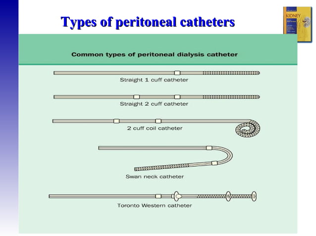 11 Peritoneal Dialysis | PPT | Digestive Disorders | Diseases and ...