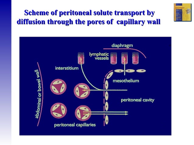 11 Peritoneal Dialysis | PPT | Digestive Disorders | Diseases and ...