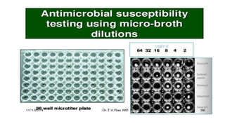 Procedure of sensitivity - Microbiology for Lab Technicians | PPT