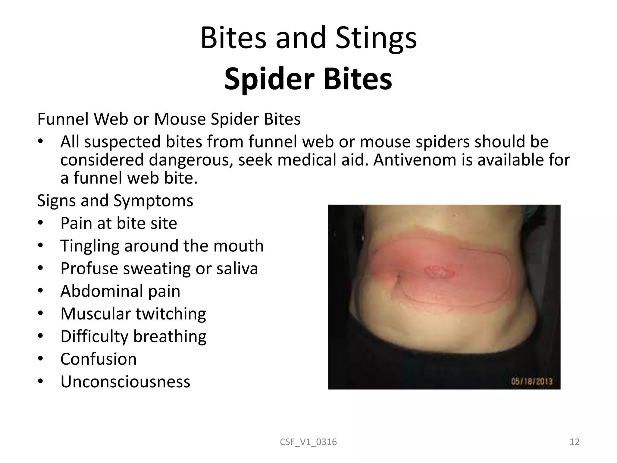 11 provide frist aid bites stings | PPTX