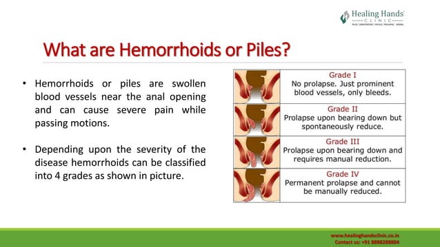 11 Self Care Tips to Prevent Hemorrhoids | PPT | Free Download