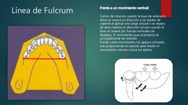 11 seminario diente pilar y biomecanica