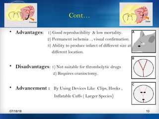 Screening model for stroke. | PPT