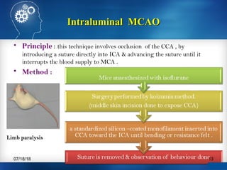 Screening model for stroke. | PPT