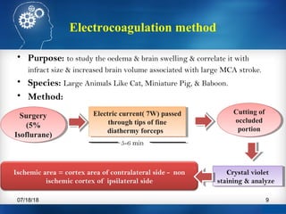 Screening model for stroke. | PPT
