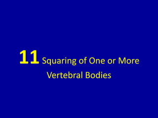 11 squaring of one or more vertebral bodies | PPTX | Bone and Joint ...
