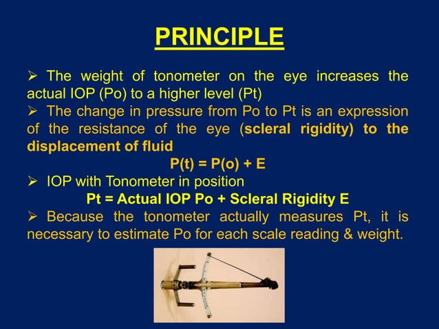 Tonometry | PPT
