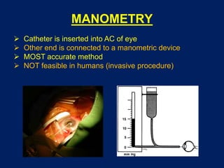 Tonometry | PPT