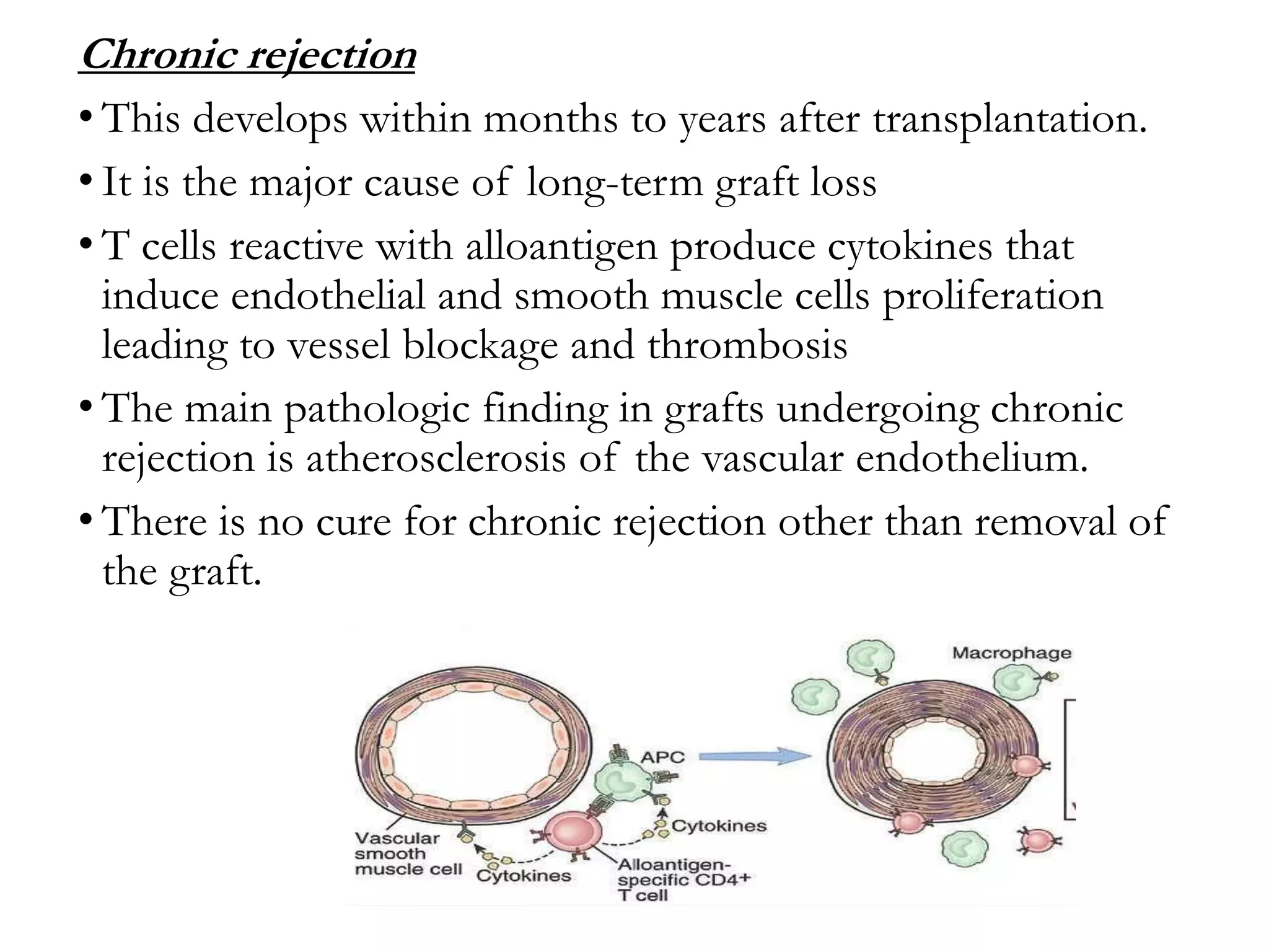 11_Transplantation_Immunity_types_of_grafts,_mechanisms_of_graft.ppt