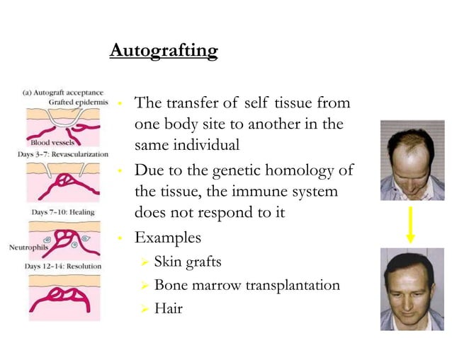 11_Transplantation_Immunity_types_of_grafts,_mechanisms_of_graft.ppt ...