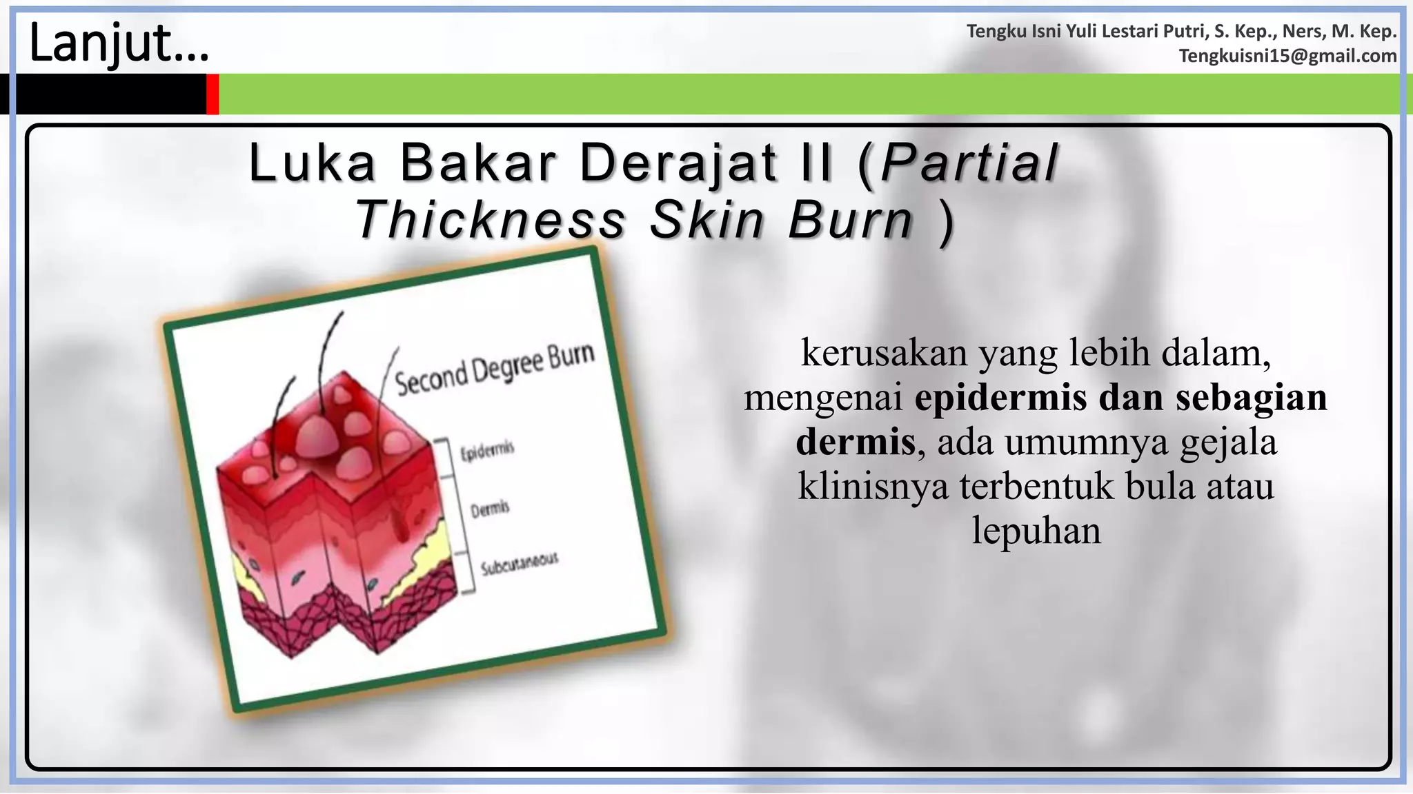 11 Trauma Kepala (Heart Injury) dan Luka Bakar.pptx