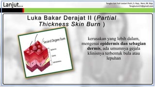 11 Trauma Kepala (Heart Injury) dan Luka Bakar.pptx