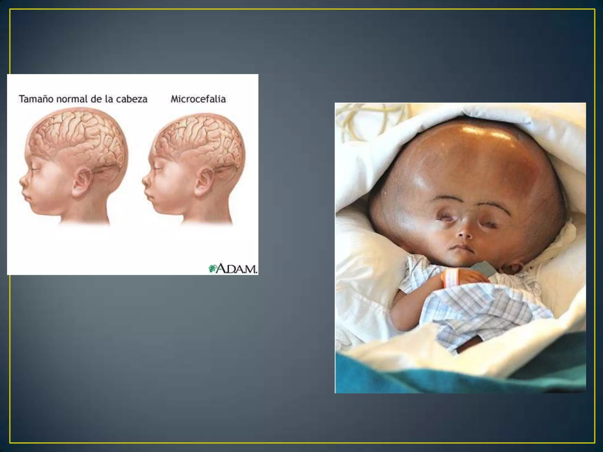 12. exploracion de cabeza (17 sep-2013) | PPT