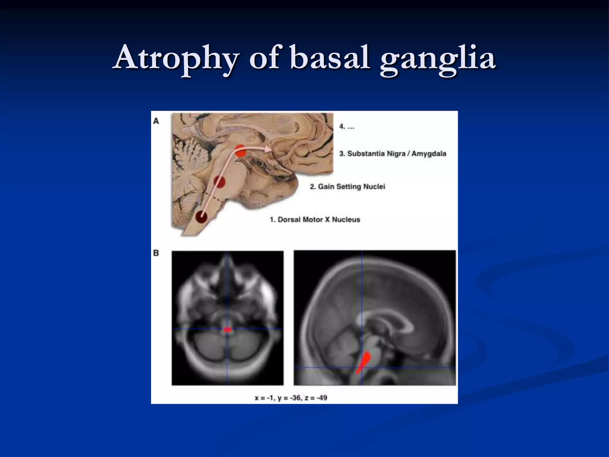 12. neurodegenerative disease timothy kwok | PDF