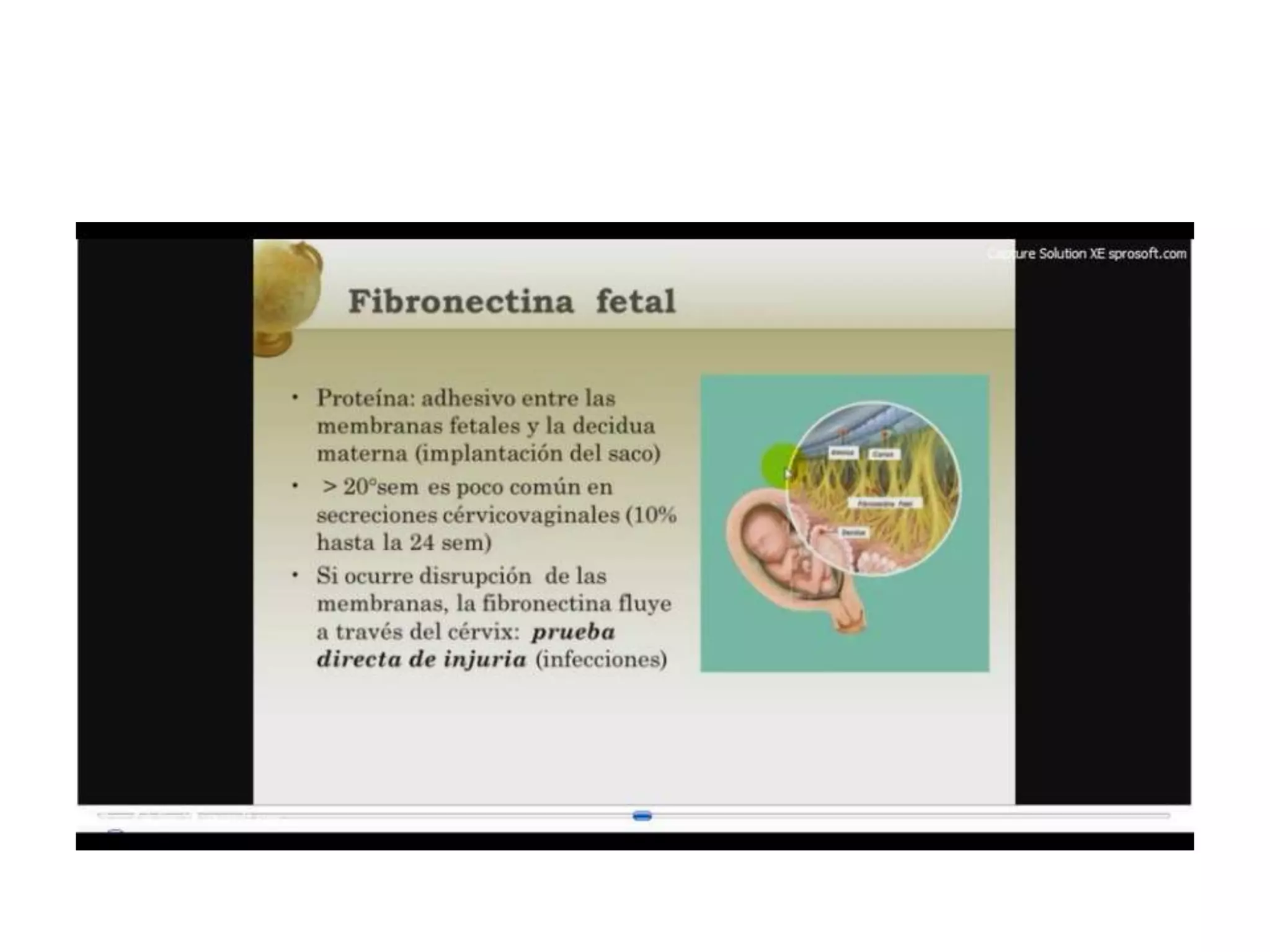 12. parto pretermino - tocolisis | PPTX