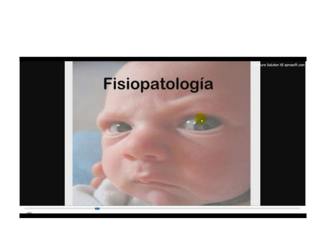 12. parto pretermino - tocolisis | PPTX