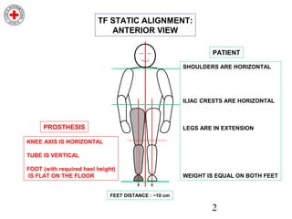 Transfemoral Static Alignment | PPT