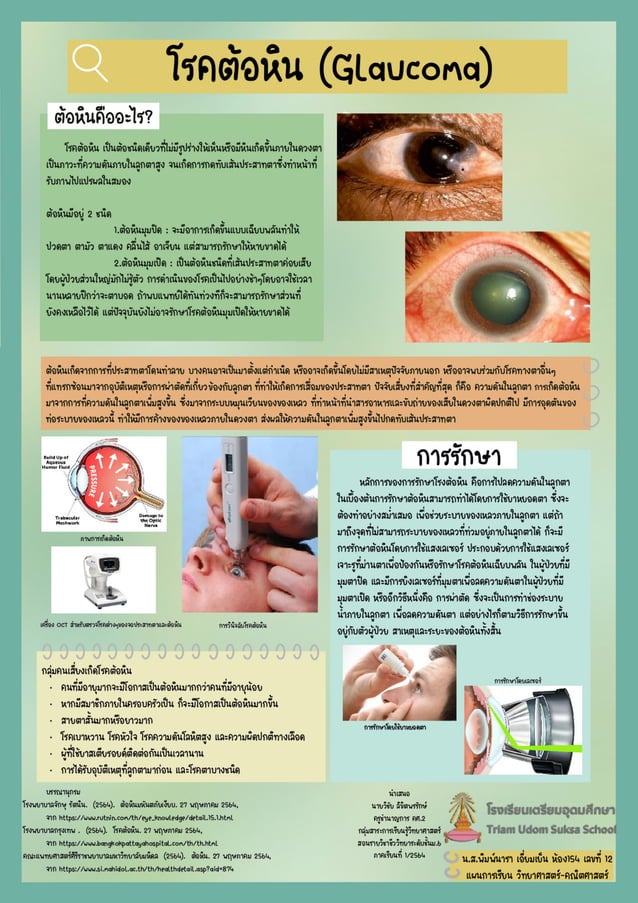12 154pimnara poster glaucoma | PDF