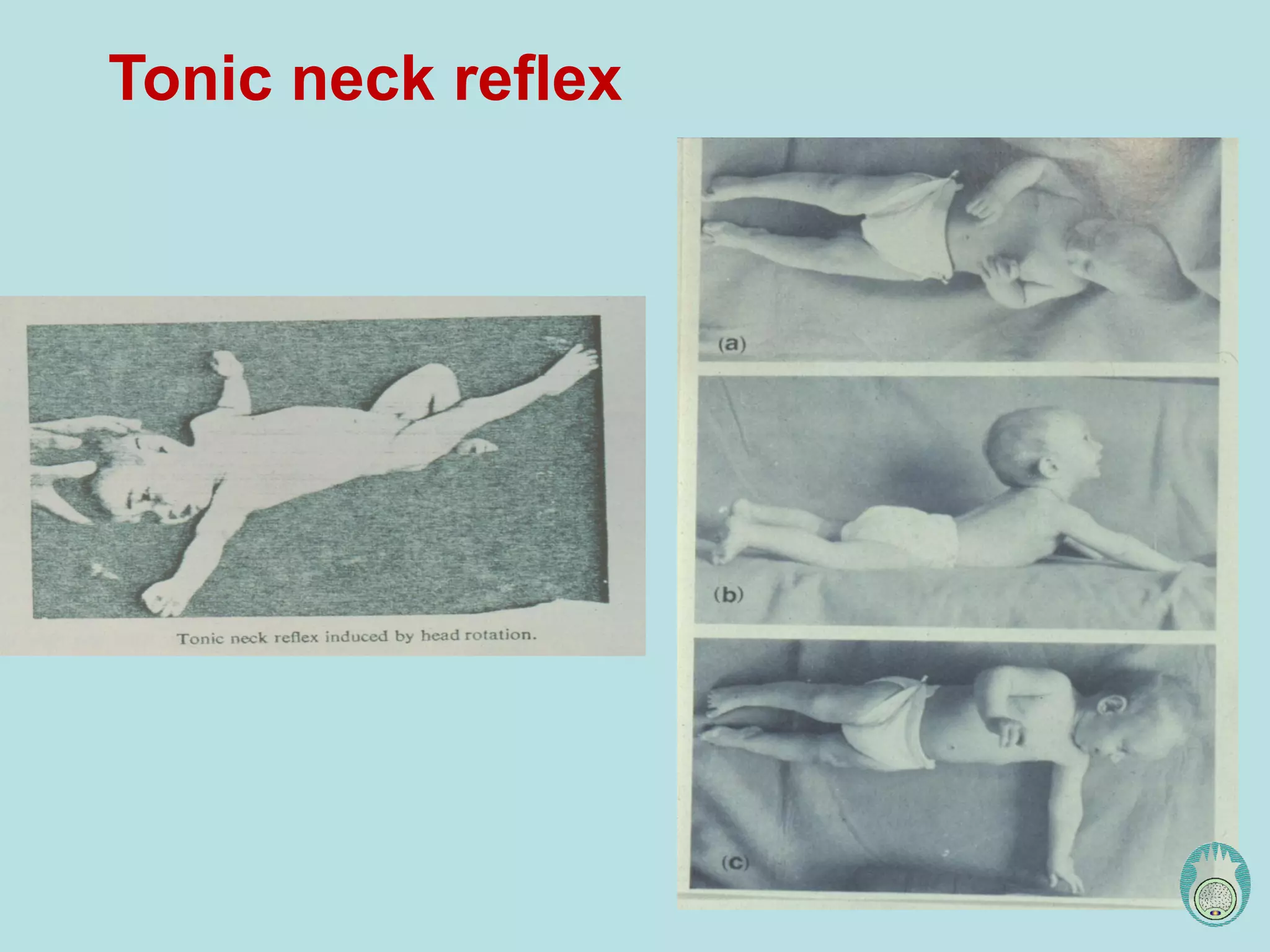 12.postural reflexes kjg | PDF