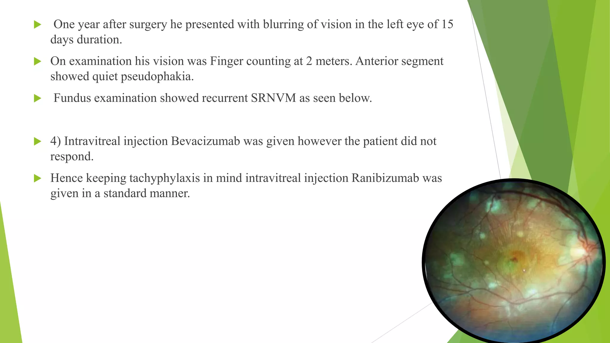 Severe Inflammation following intravitreal injection Ranibizumab ...