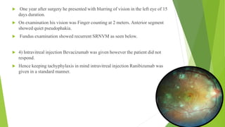 Severe Inflammation following intravitreal injection Ranibizumab ...