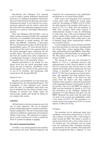 Complications of Third Molar Surgery | PDF