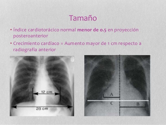 Radiologia en Enfermedades cardiovasculares