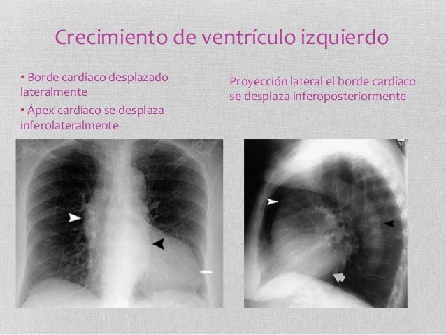 Radiologia en Enfermedades cardiovasculares