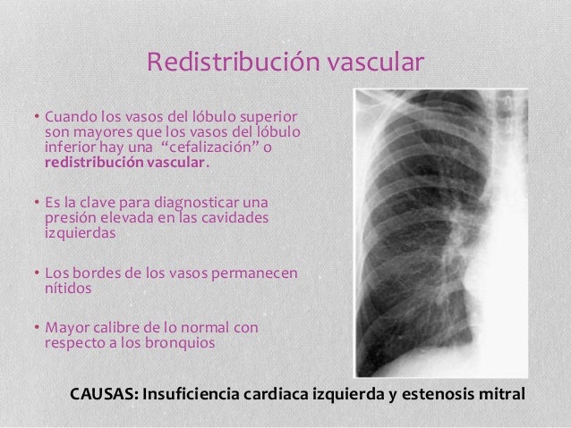 Radiologia en Enfermedades cardiovasculares