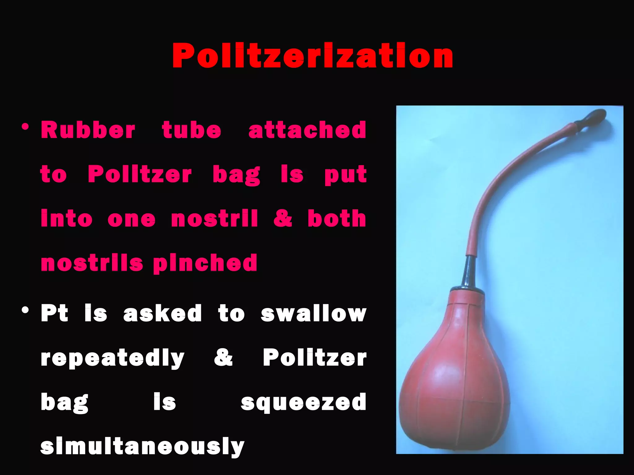 Non suppurative otitis media | PPT