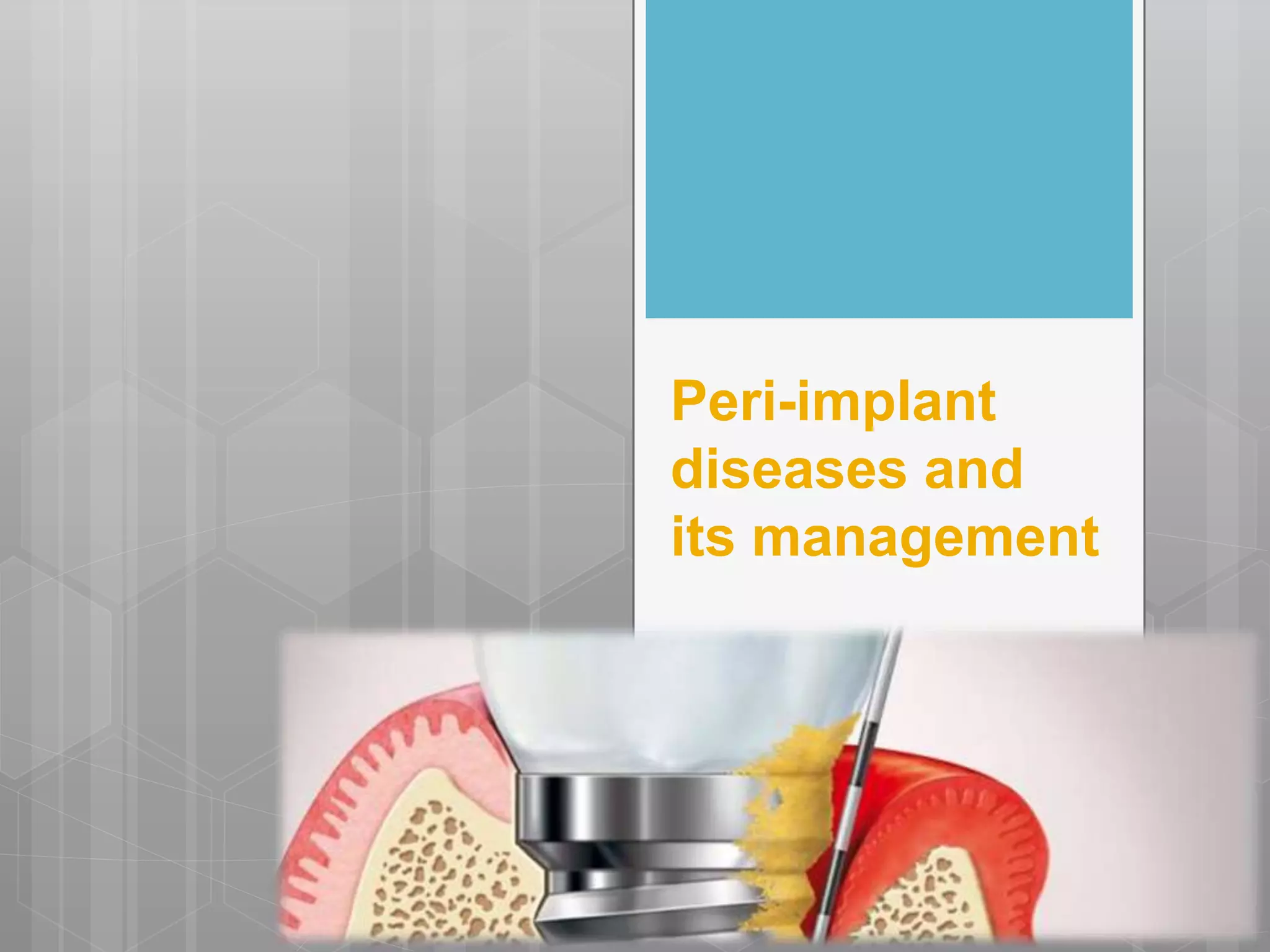 Peri implant Diseases and its management | PPTX