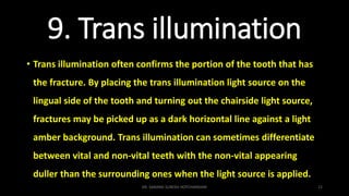 12 STEPS TO DIAGNOSE THE TEETH | PPTX