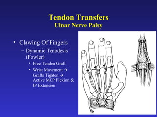 12. tendon transfers | PPT