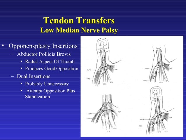 12. tendon transfers