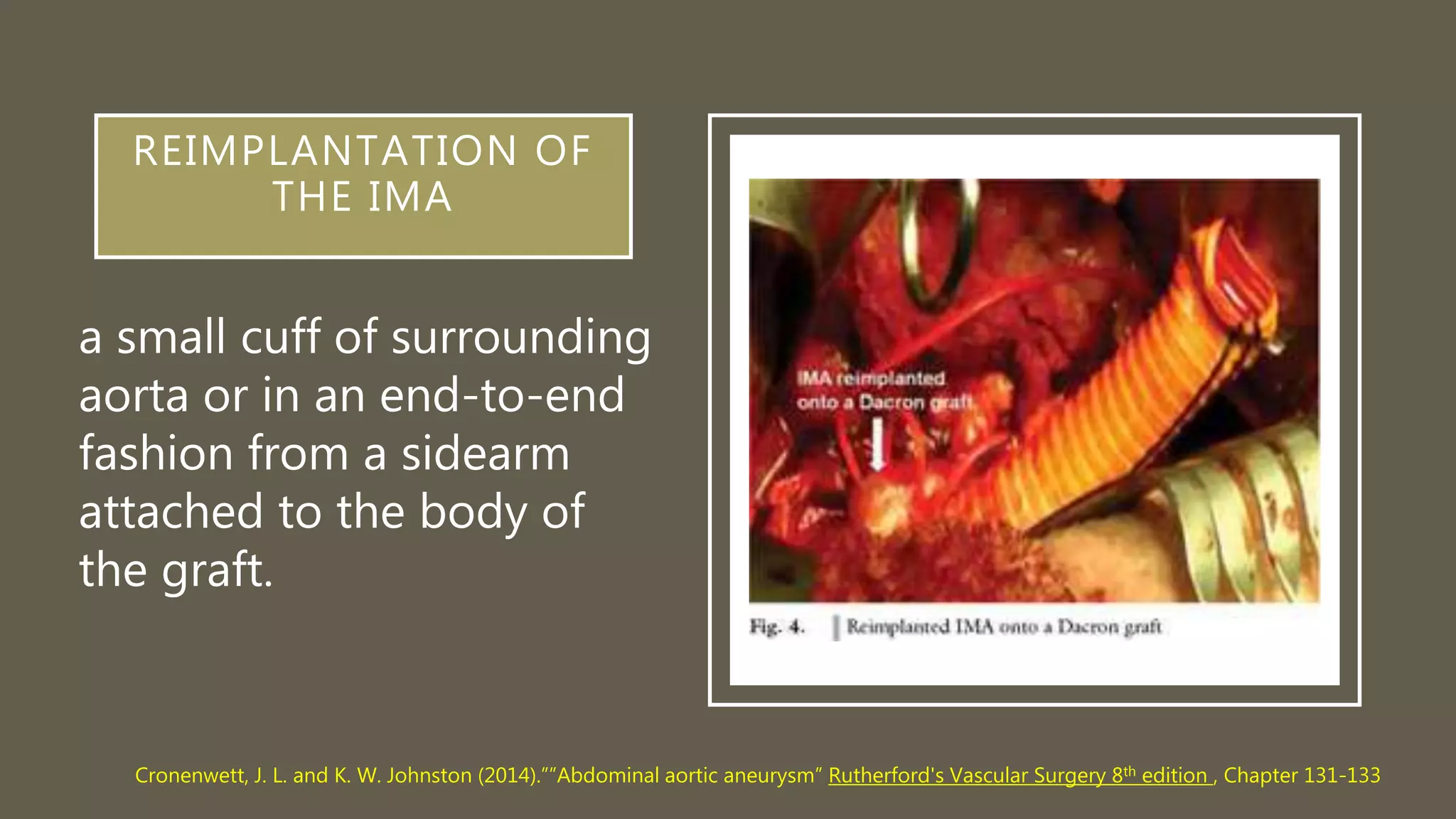 12.3.61 colonic ischemia in evar & open repair aaa | PPTX